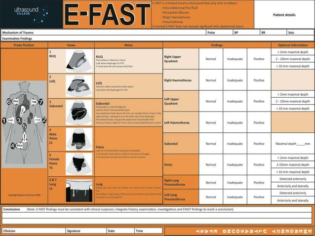 EFAST - A how to guide | PPTX | First Aid | Injuries