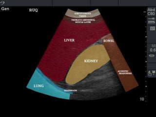 EFAST - A how to guide | PPTX