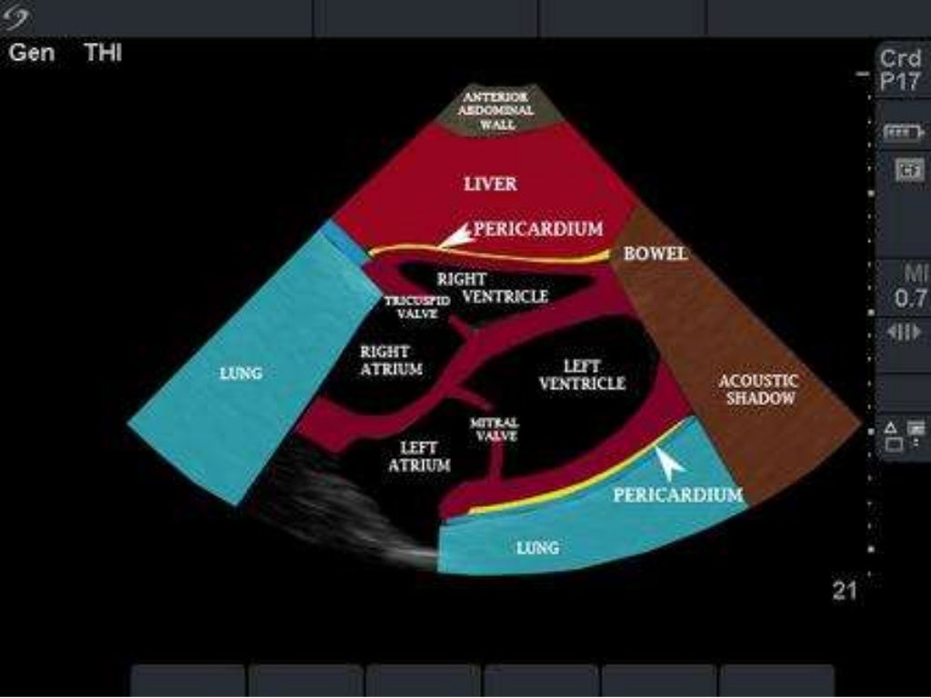 EFAST - A how to guide