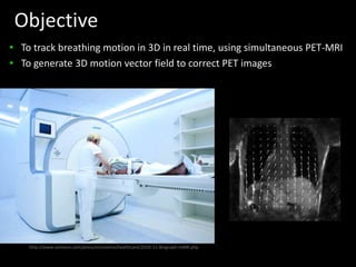 Real-time 3D MR Respiratory Motion Acquisition for Simultaneous PET-MR Imaging | PPT