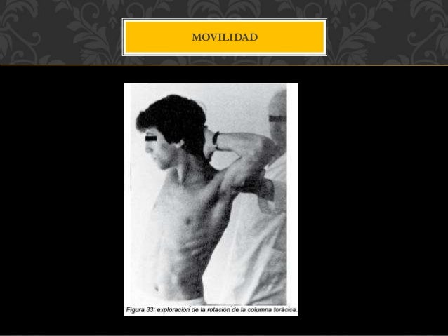 EXAMEN FISICO columna