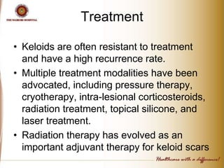 Keloids | PPTX