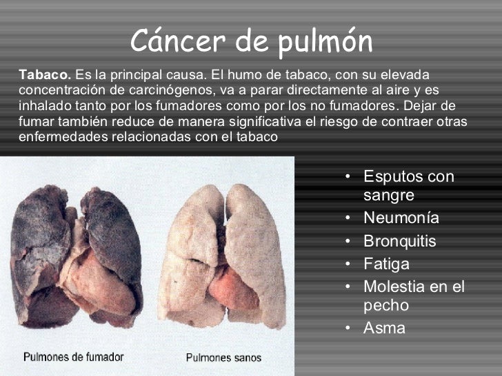 Efectos Del Cigarrillo En El Cuerpo Humano