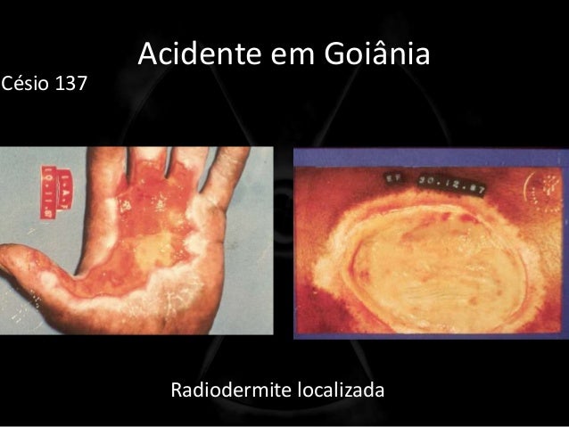 Efeitos Biológicos da Radiação Ionizante
