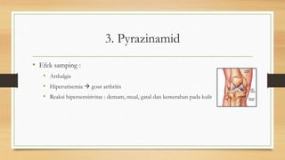 Efek Samping Obat Anti Tuberkulosis (Lini satu.pptx