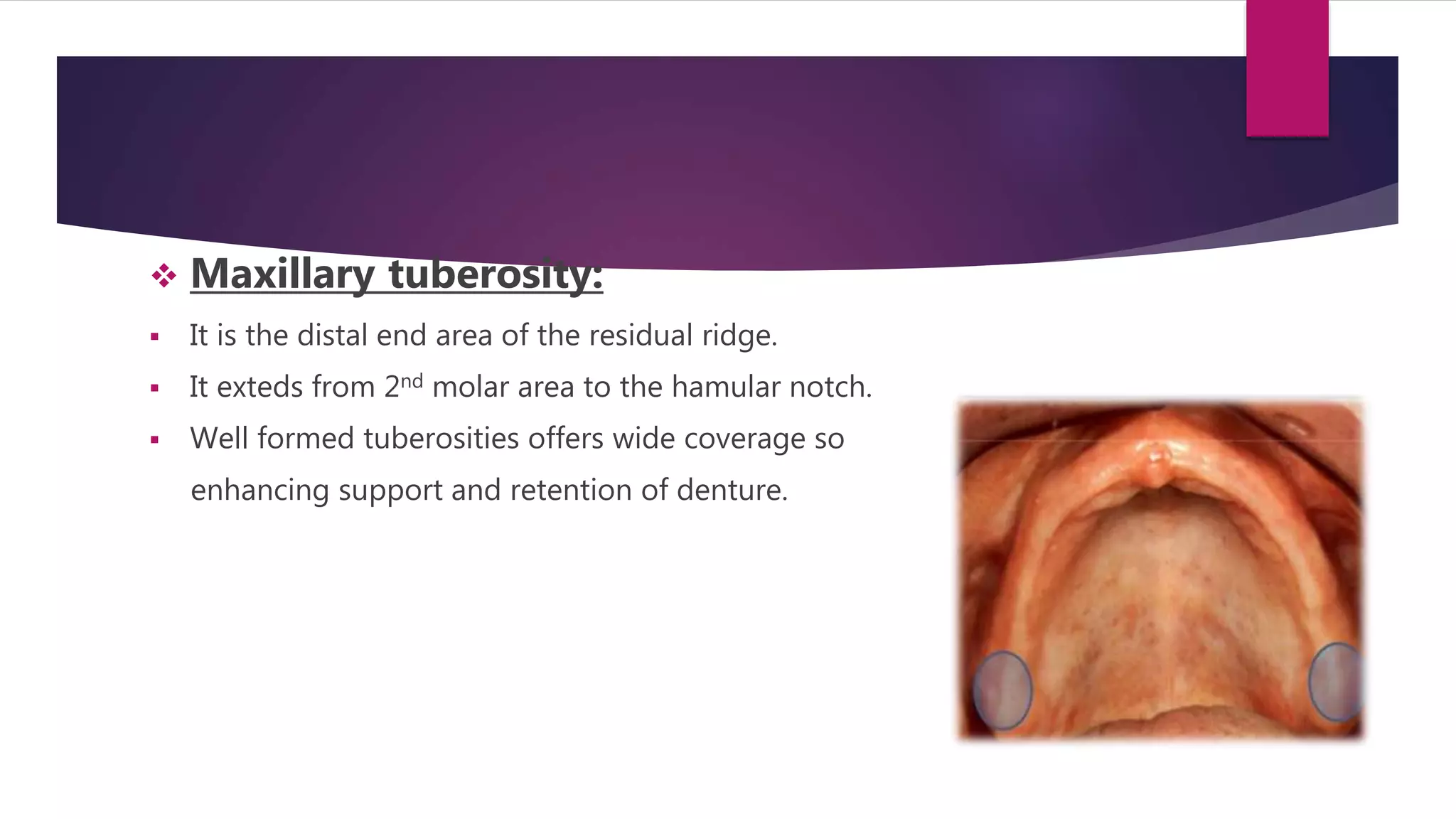 Anatomical landmarks of edentulous maxillary arch | PPTX