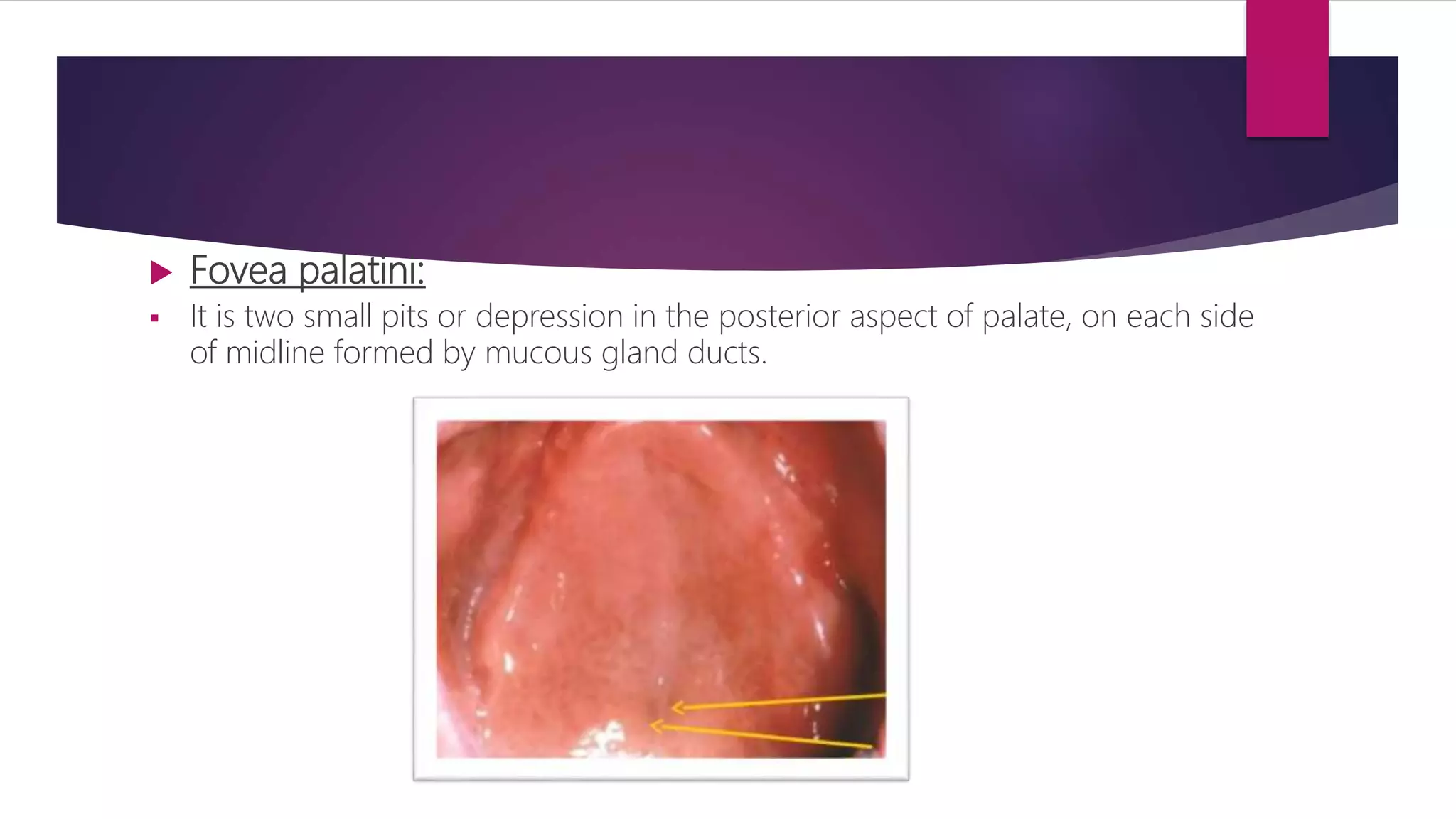 Anatomical landmarks of edentulous maxillary arch | PPTX