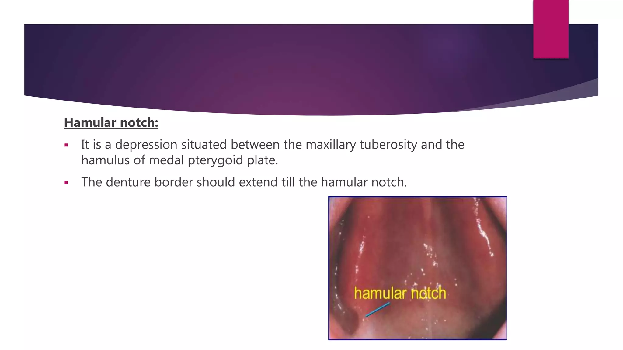 Anatomical landmarks of edentulous maxillary arch | PPTX