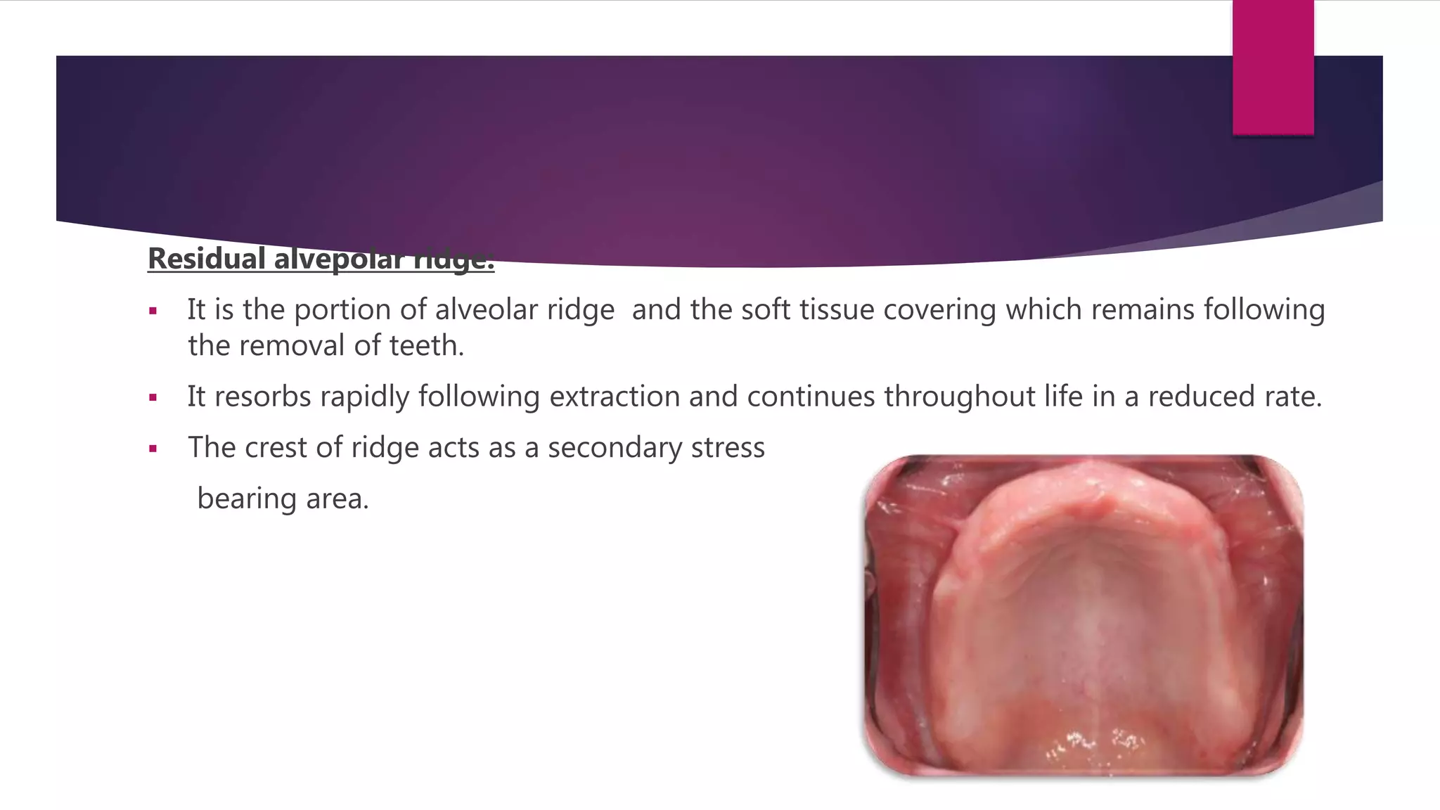 Anatomical landmarks of edentulous maxillary arch | PPTX