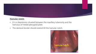 Anatomical landmarks of edentulous maxillary arch | PPTX