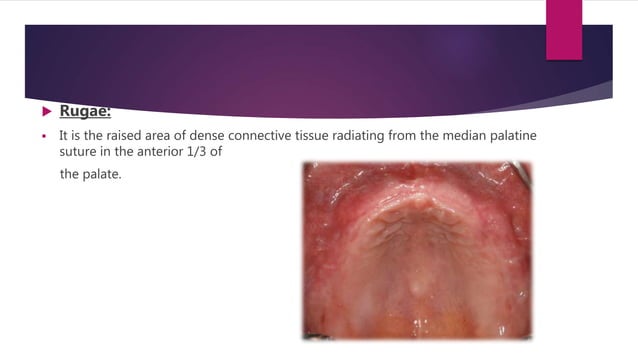 Anatomical landmarks of edentulous maxillary arch | PPT