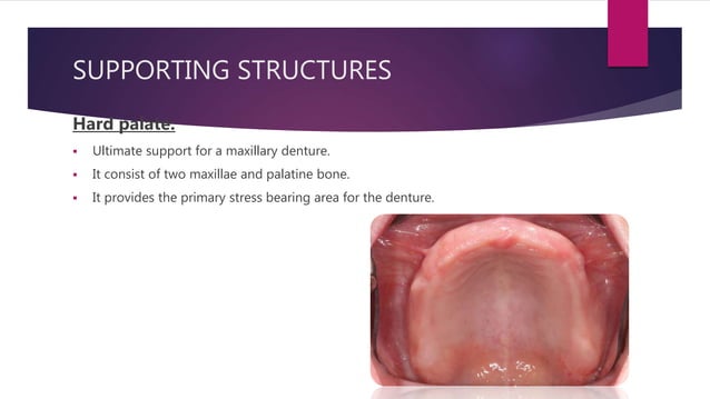 Anatomical landmarks of edentulous maxillary arch | PPT