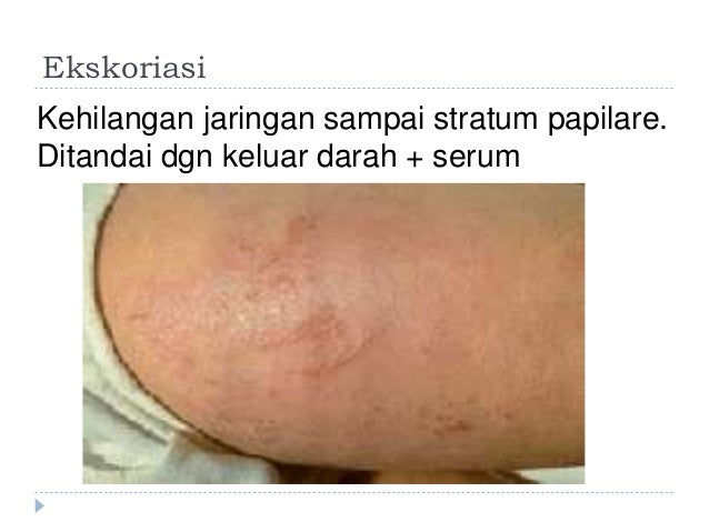 Eff. sekunder (modul kulit dan jaringan penunjang)