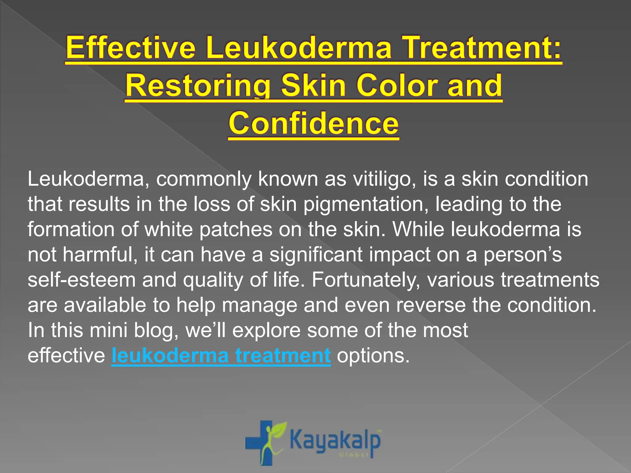 Effective Leukoderma Treatment.pptx