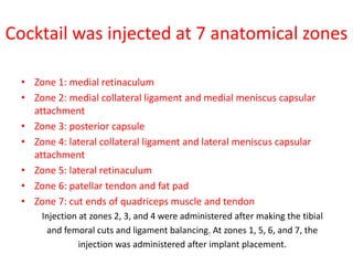 periarticular cocktail injection in total knee replacement | PPTX ...