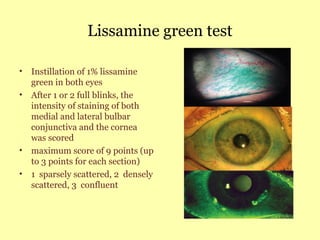 Effectiveness of rituximab treatment in primary sjogren’s syndrome | PPT