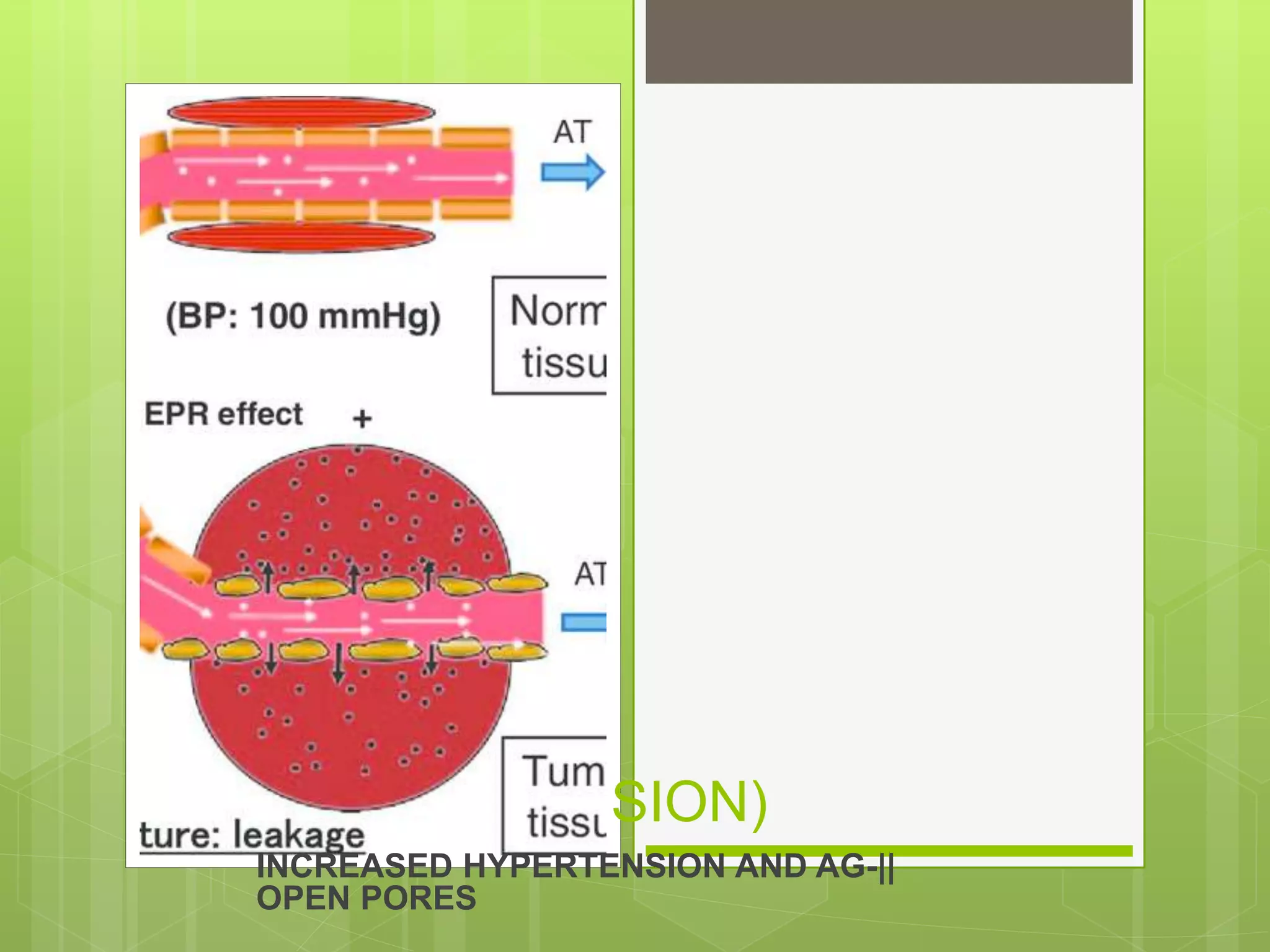 Effective permeation and retention effect [epr effect | PPTX