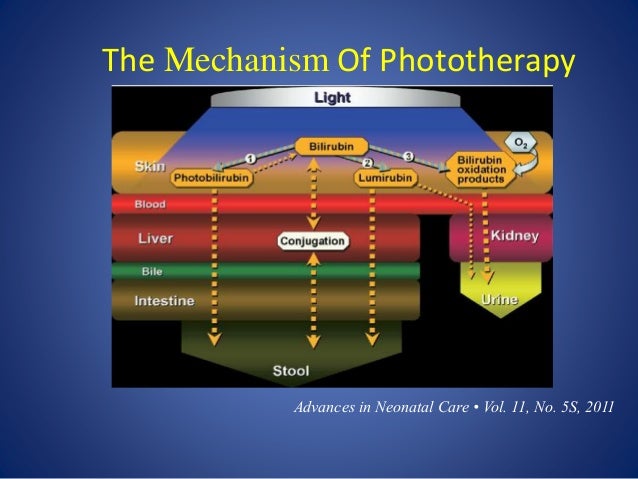 Effective phototherapy for neonatal jaundice