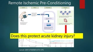 Effect Of Remote Ischemic Preconditioning On AKI Among.pptx