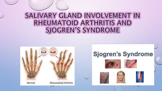Effect of systemic diseases on salivary glands | PPT