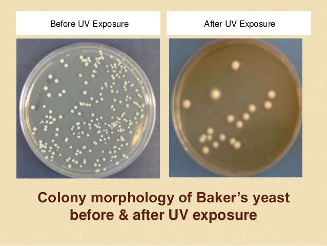 Effect of UV Rays on the Colonial & Cellular Morphology and Catalase