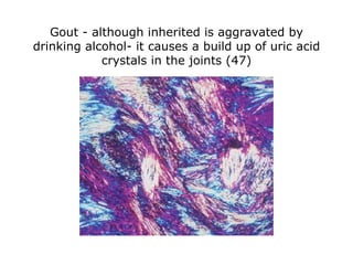 effects of alcohol on body | PPT