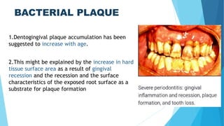 Effects Of Aging on Periodontium.pptx | Oral care | Personal Care