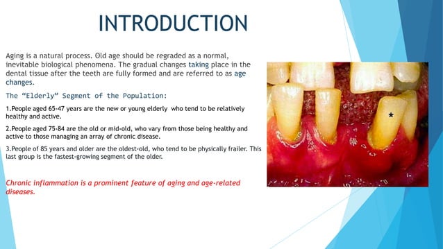 Effects Of Aging on Periodontium.pptx | Oral care | Personal Care