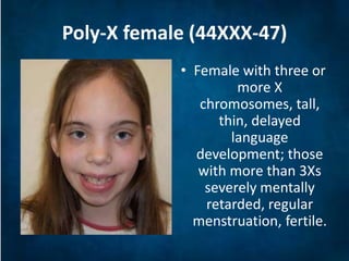 Effects of changes in sex chromosomes number | PPT