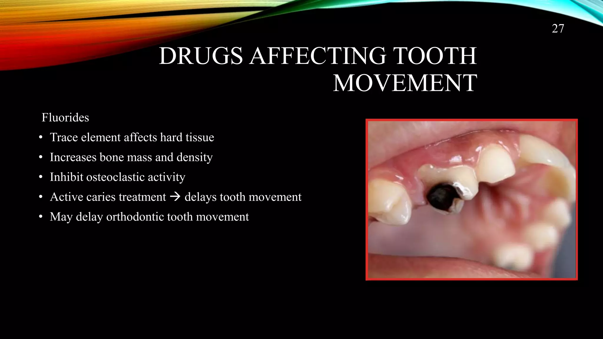 Effects of drugs on orthodontic treatment | PPTX