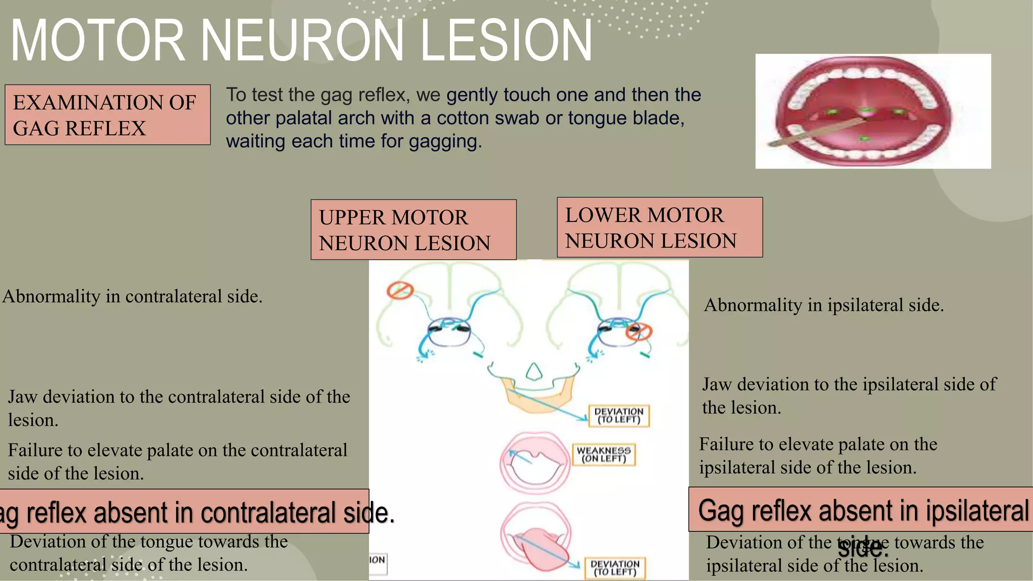 Effects of Gagging.pptx