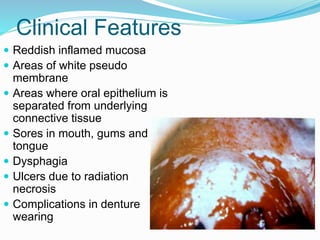 Effects of radiation on oral tissues | PPTX