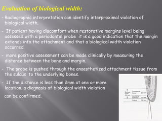 Effects of Restorative Procedure on Periodontium.ppt