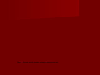 Effects of setback distance | PPT