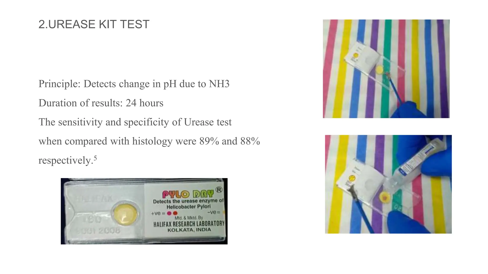 “Efficacy and feasibility of Narrow Band Imaging Endoscopy for ...