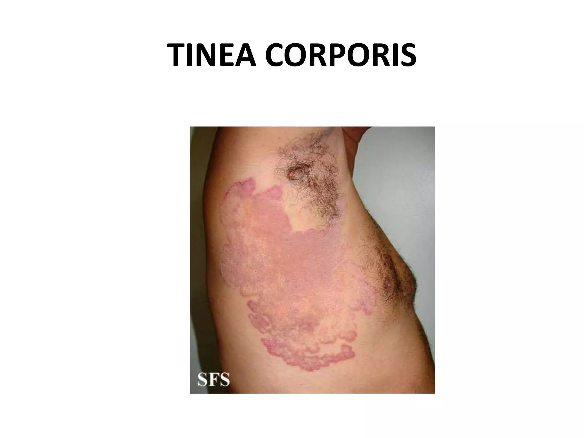 Efficacy of herbomineral formulations in dermatological practice - Dr ...