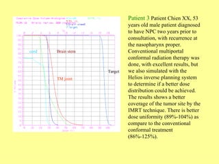 Efficacy Of Imrt Through Dmlc And Inverse Planning | PPT
