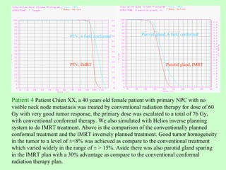 Efficacy Of Imrt Through Dmlc And Inverse Planning | PPT