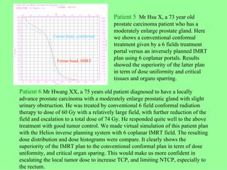Efficacy Of Imrt Through Dmlc And Inverse Planning | PPT
