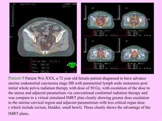Efficacy Of Imrt Through Dmlc And Inverse Planning | PPT