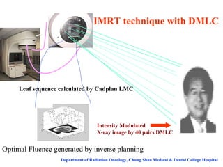 Efficacy Of Imrt Through Dmlc And Inverse Planning | PPT