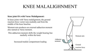 Efficacy of knee orthosis and foot orthosis in knee osteoarthritis ...