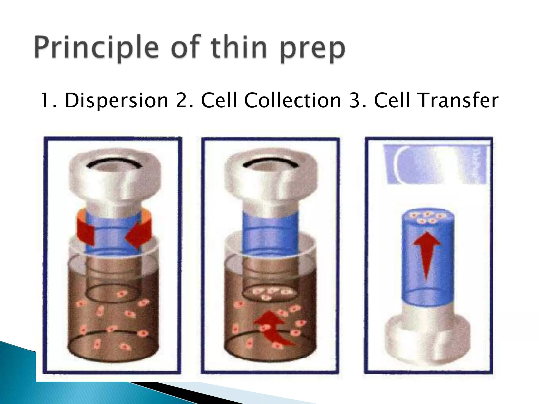 Efficacy of liquid based cytology versus conventional smears | PPT