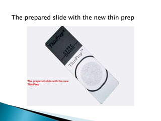 Efficacy of liquid based cytology versus conventional smears | PPTX