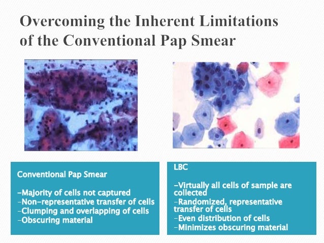 Efficacy of liquid based cytology versus conventional smears
