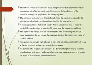 Efficiency of piezotome CORTICISION ASSISTED ORTHODONTICS | PPT
