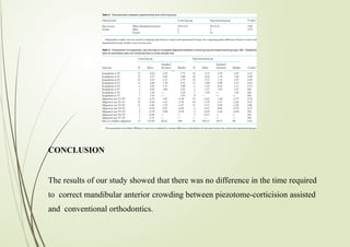 Efficiency of piezotome CORTICISION ASSISTED ORTHODONTICS | PPT
