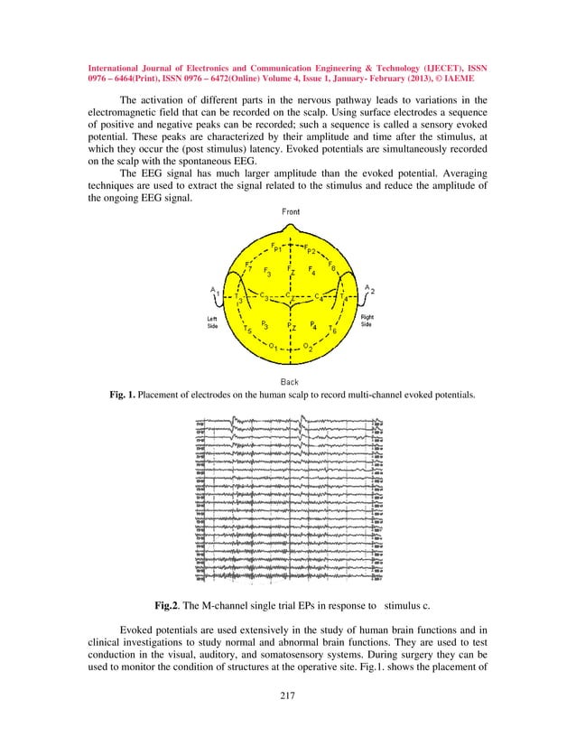 Efficient extraction of evoked potentials from noisy background eeg ...