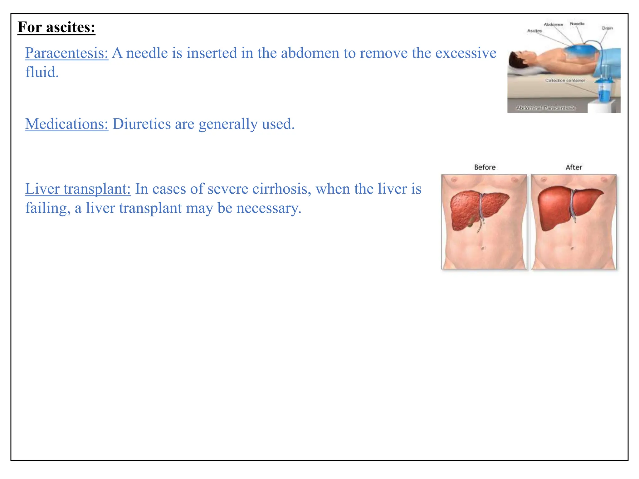 Effusion (Ascites, Pleural Effusion); Human Anatomy And Physiology ...