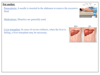 Effusion (Ascites, Pleural Effusion); Human Anatomy And Physiology | PPTX